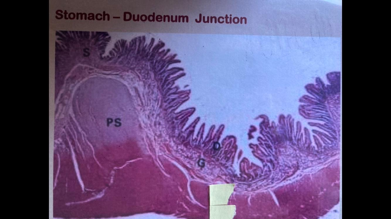 Solved Stomach - Duodenum Junction S PS | Chegg.com