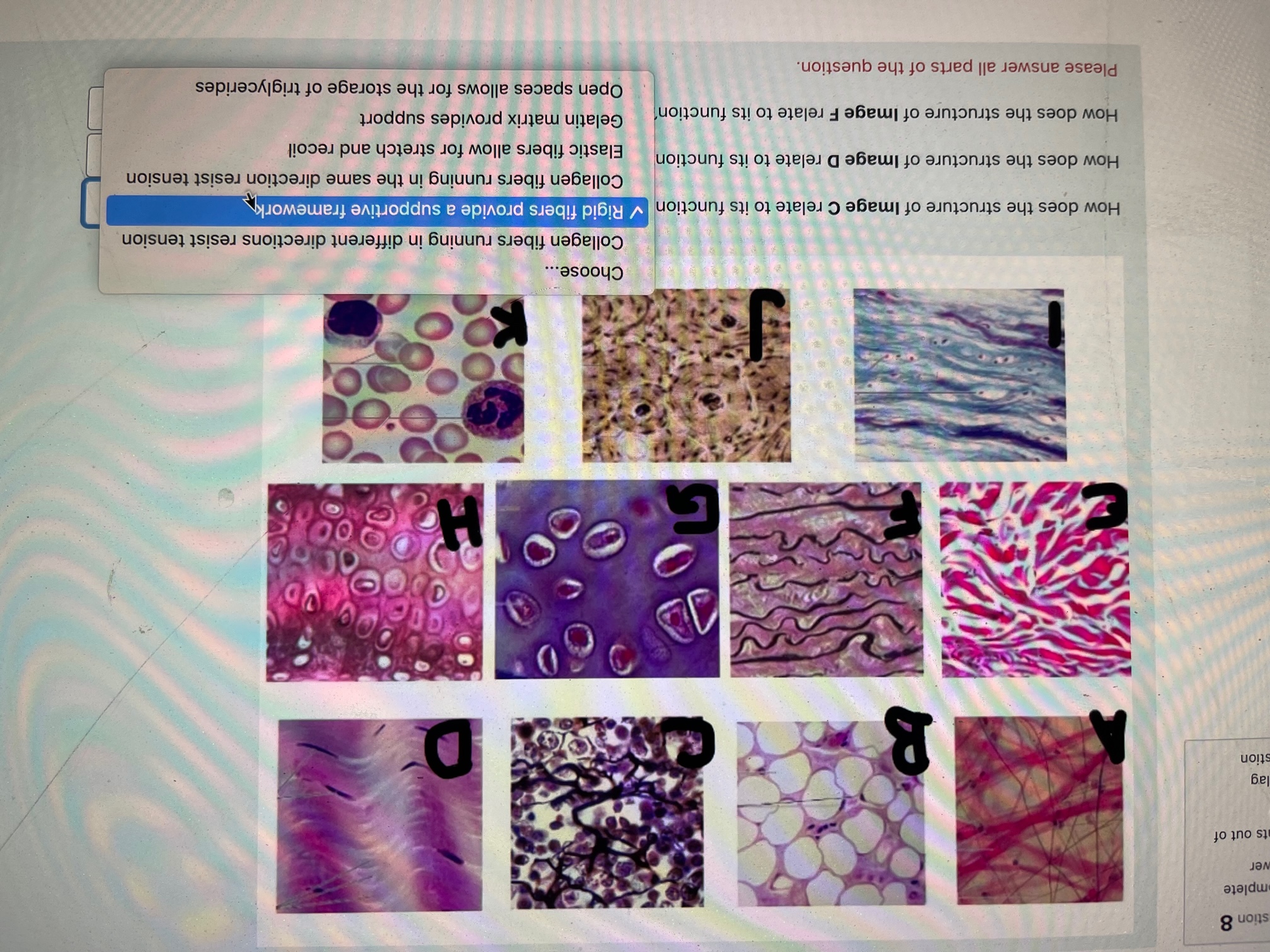 Solved Choose... Collagen fibers running in different | Chegg.com