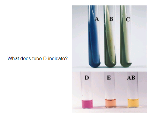Solved . a.The bacteria produces the enzyme urease b. The | Chegg.com