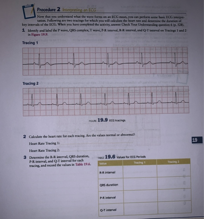 Solved Procedure 1 Correlating Points On An Ecg With