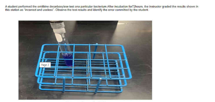 Solved A student performed the ornithine decarboxylase test | Chegg.com