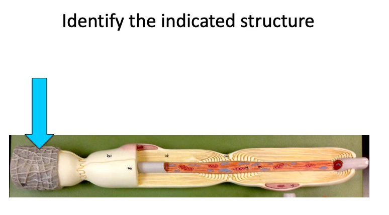 Solved Identify the indicated structure 2 | Chegg.com