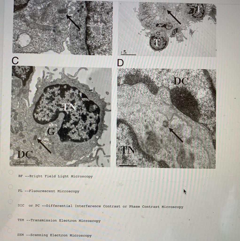 Solved Examine this micrograph examining the synapse between | Chegg.com