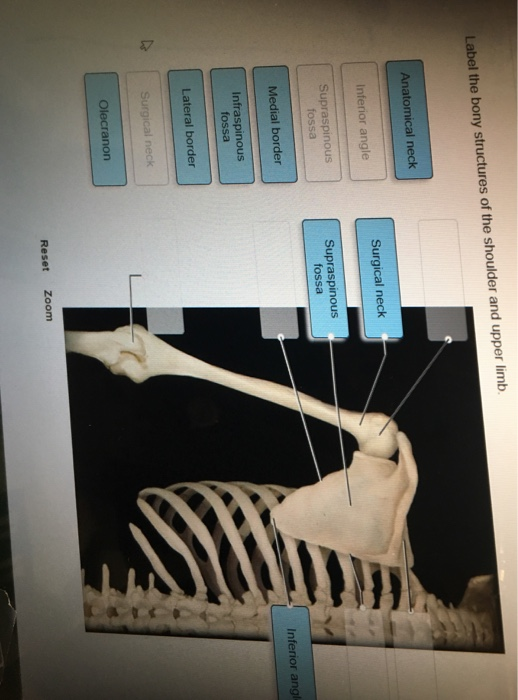 Solved Label the bony structures of the shoulder and upper | Chegg.com