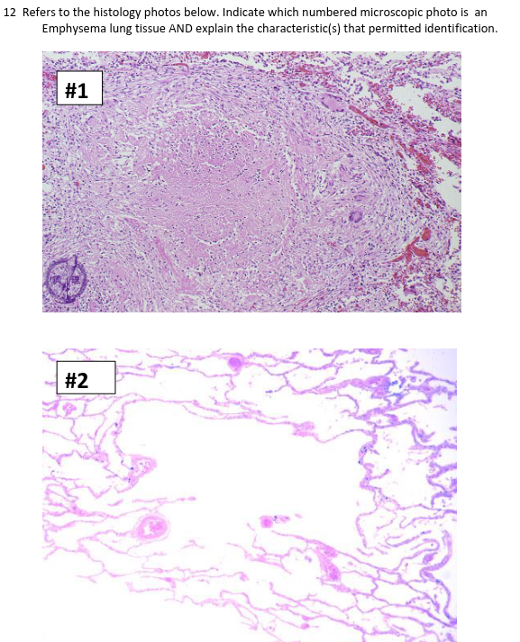 Solved 12 ﻿Refers to the histology photos below. Indicate | Chegg.com
