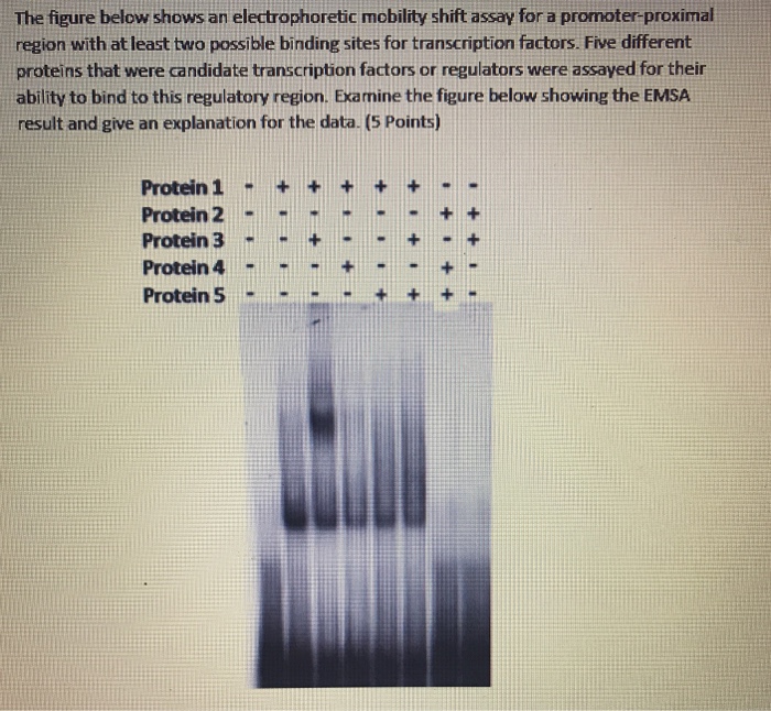 Solved The figure below shows an electrophoretic mobility | Chegg.com
