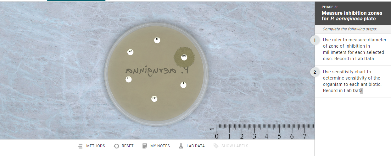 PHASE 3: Measure inhibition zones for P aeruginosa | Chegg.com