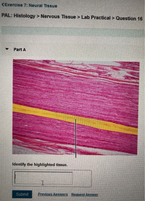 Solved Exercise 7: Neural Tissue PAL: Histology >Nervous | Chegg.com