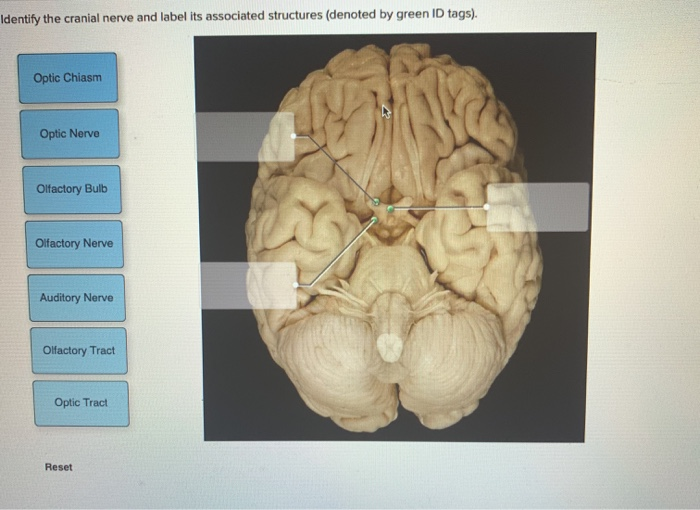 Solved Identify the cranial nerve and label its associated | Chegg.com