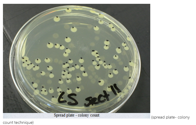 Solved ENVIRONMENTAL SPECIMEN Spread-Plate Technique | Chegg.com