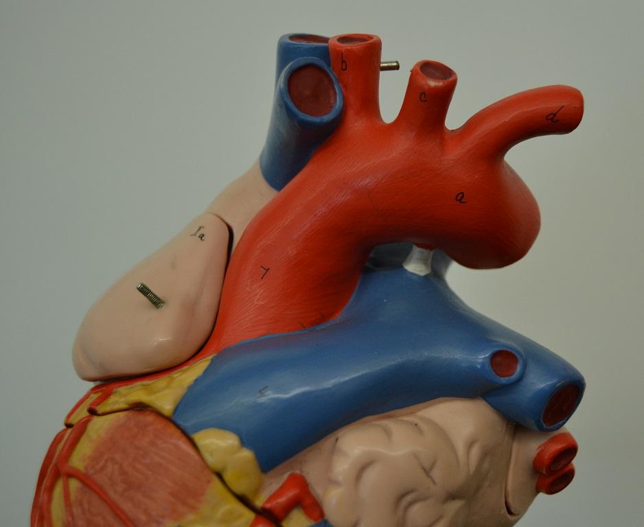 Solved Obtain a heart, dissection tray, gloves and tools | Chegg.com