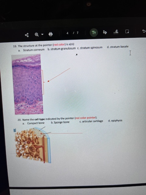 Solved 17. Name the structure indicated by the red color | Chegg.com