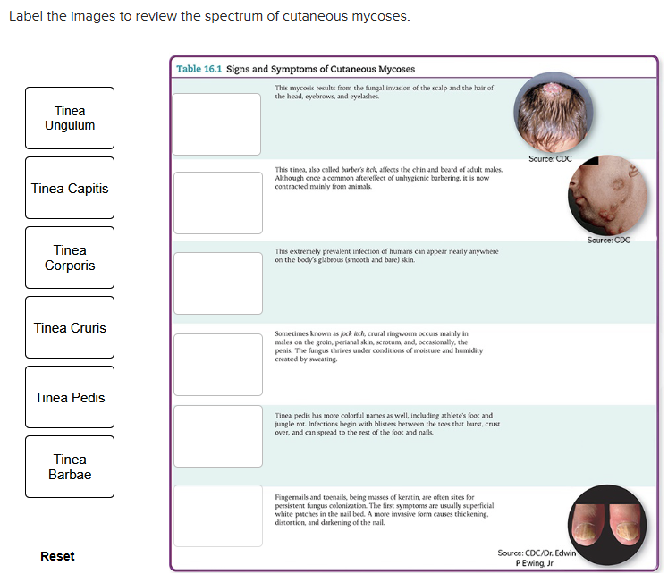 Solved Label the images to review the spectrum of cutaneous | Chegg.com