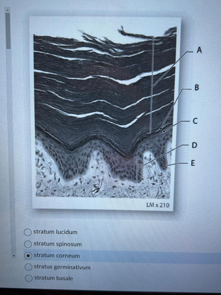 Solved stratum lucidum stratum spinosum stratum corneum | Chegg.com