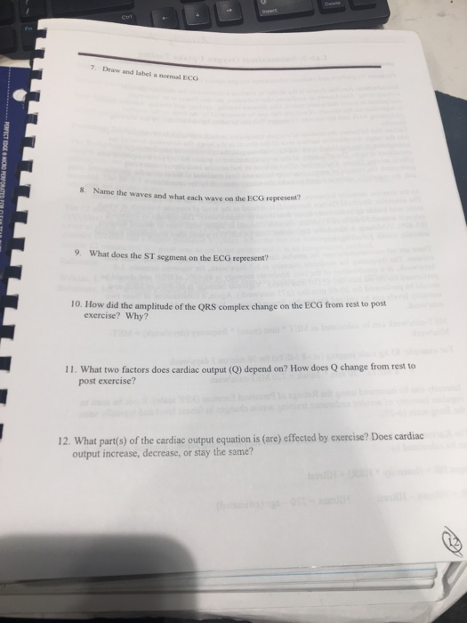 Solved 7. Draw and label a normal ECO Name the waves and | Chegg.com