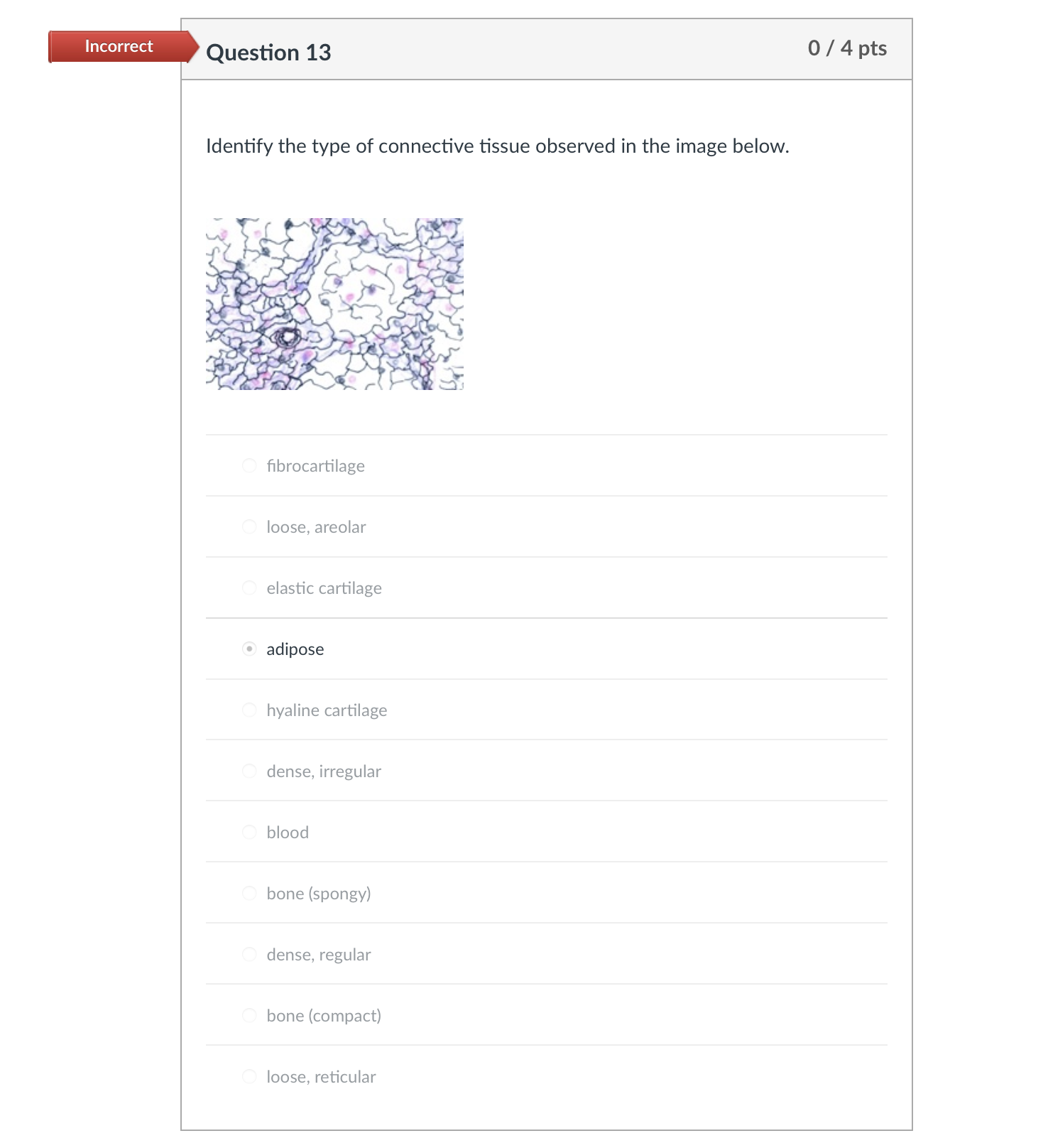 Solved Question 13Identify the type of connective tissue | Chegg.com