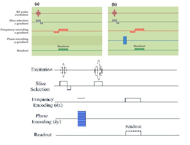 (a) (b) RF pulse excitation Slice selection | Chegg.com