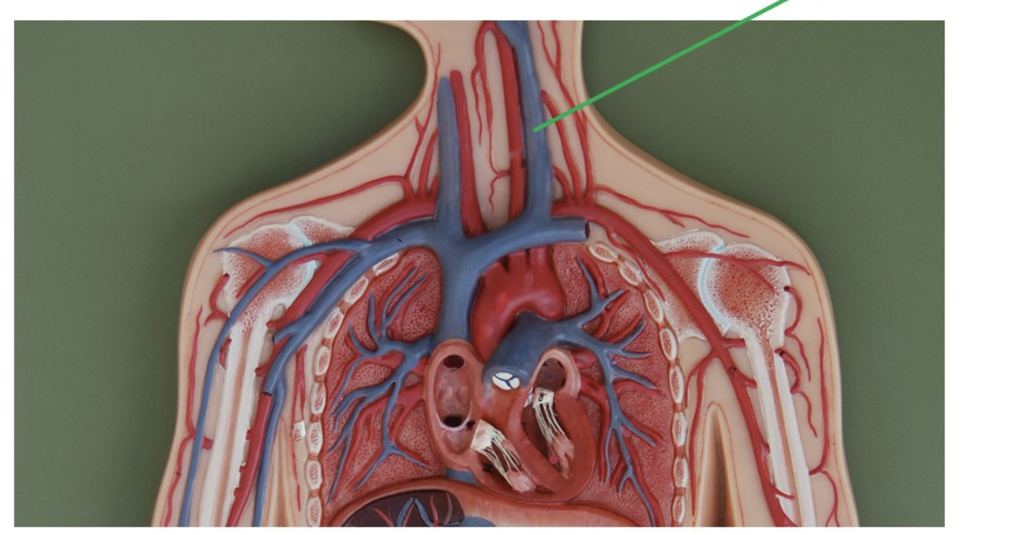 Solved Identify the arrow | Chegg.com