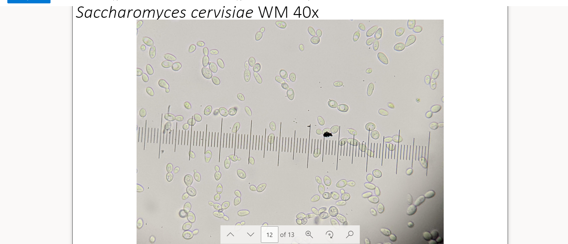 Solved Saccharomyces cervisiae WM 40x 0. um මගේ රට > 12 of | Chegg.com