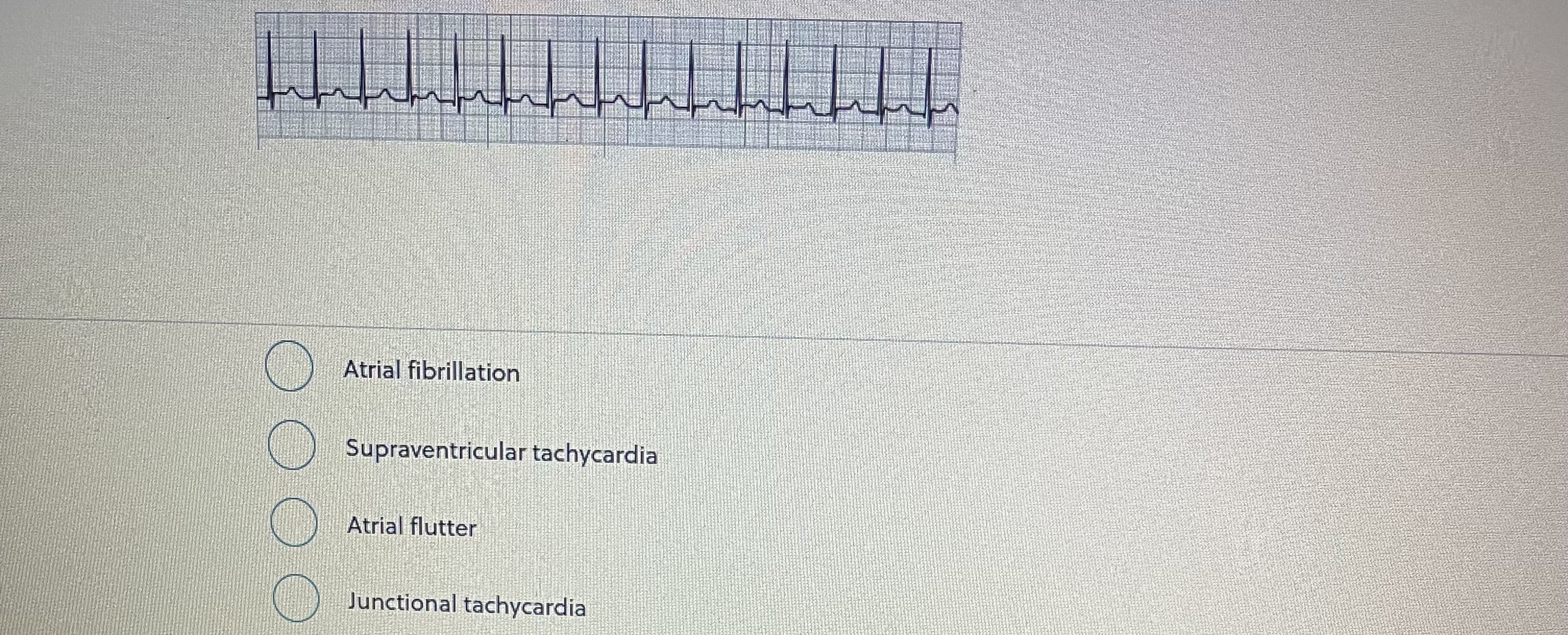 Solved Atrial fibrillation Supraventricular tachycardia | Chegg.com