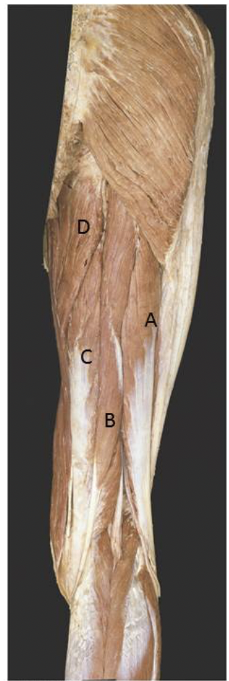 Solved Identify and name the following major muscles of the | Chegg.com