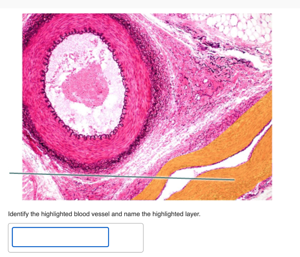 Solved Identify the highlighted vessel. Identify the | Chegg.com Solved Identify the highlighted vessel. Identify the | Chegg.com