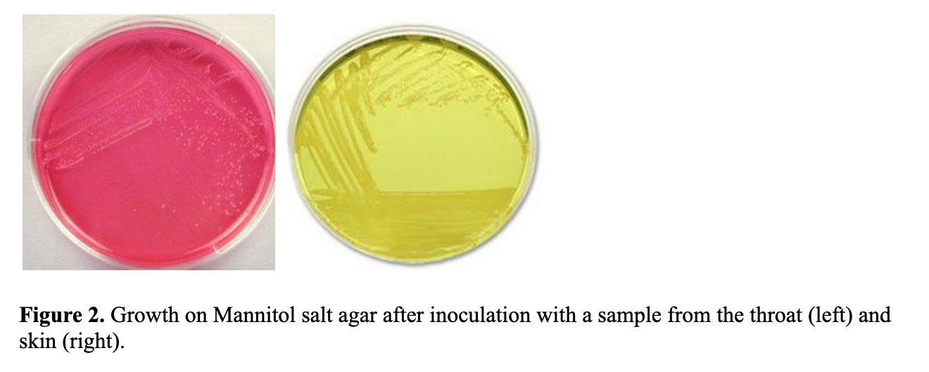 Solved Data Interpretation: After inoculating and incubating | Chegg.com