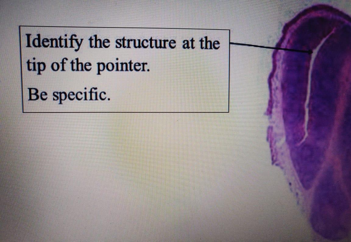 Solved Identify the region & organ at ti tip of the pointer. | Chegg.com