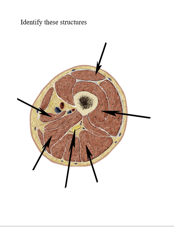 Solved Identify these structures Identify these structures | Chegg.com