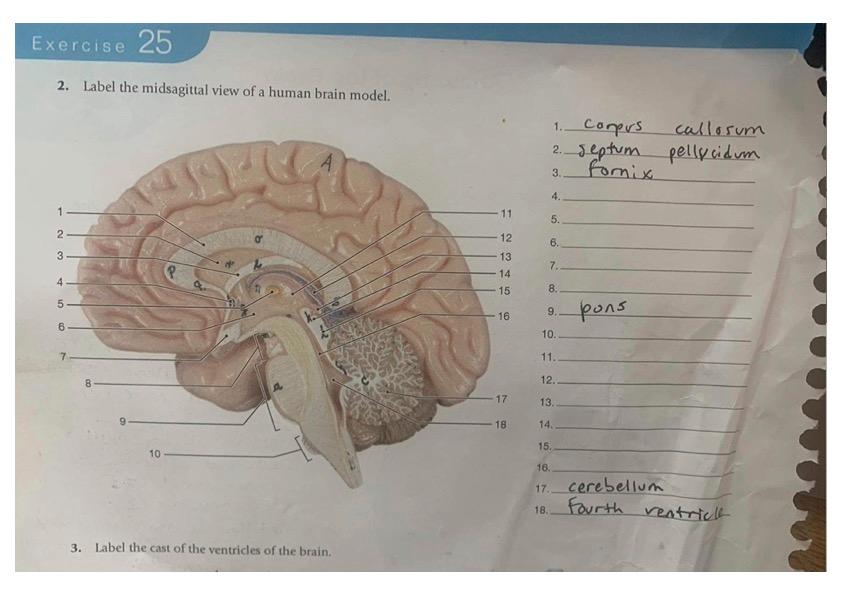 Solved 2. Label the midsagittal view of a human brain model. | Chegg.com