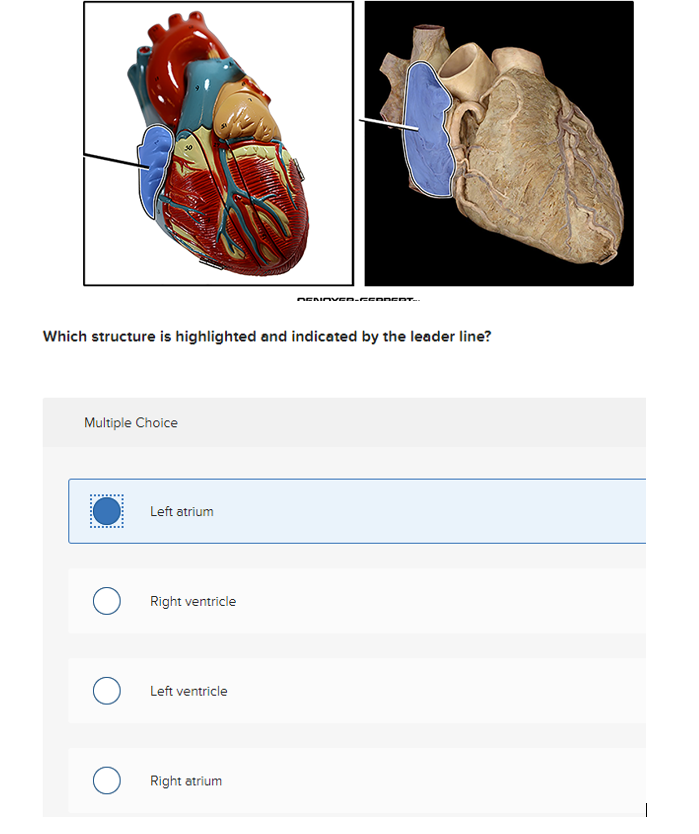 Solved RENIRVED.GEDDEDT. Which structure is highlighted and | Chegg.com