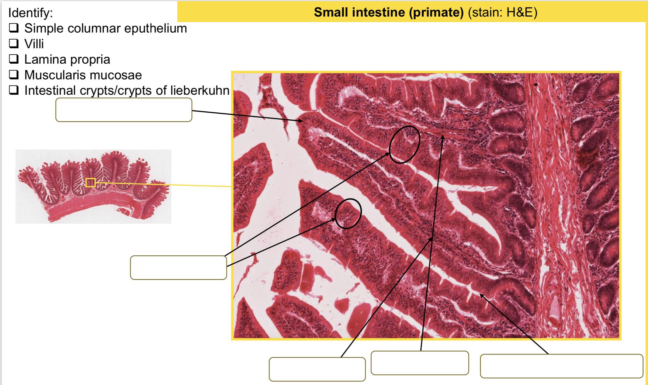Solved Large intestine (human) (stain: H\&E)Small intestine | Chegg.com