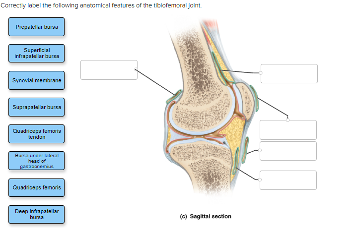 Solved Correctly label the following anatomical features of | Chegg.com