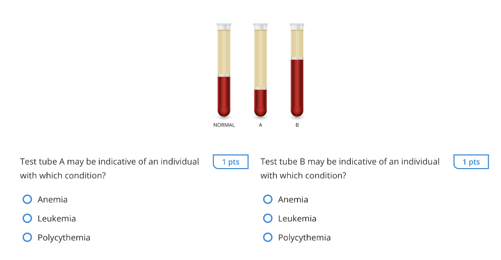 Solved What is the normal platelet count for a healthy | Chegg.com