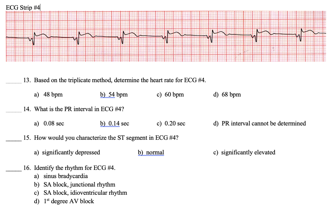 Solved ECG Strip #4 w 하 M my w 나 w w 13. Based on the | Chegg.com