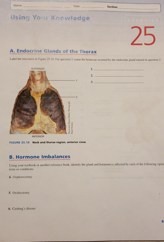 Solved 418 EXERCİSE 25-NDOCRİNE STRUCTURE C. Hormones | Chegg.com