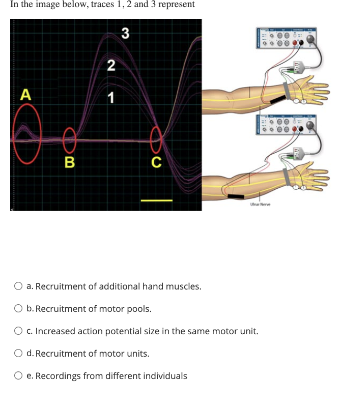 Solved In the image below, traces 1,2 and 3 represent a. | Chegg.com