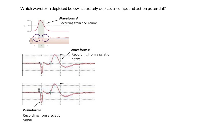 Solved Which waveform depicted below accurately depicts a | Chegg.com
