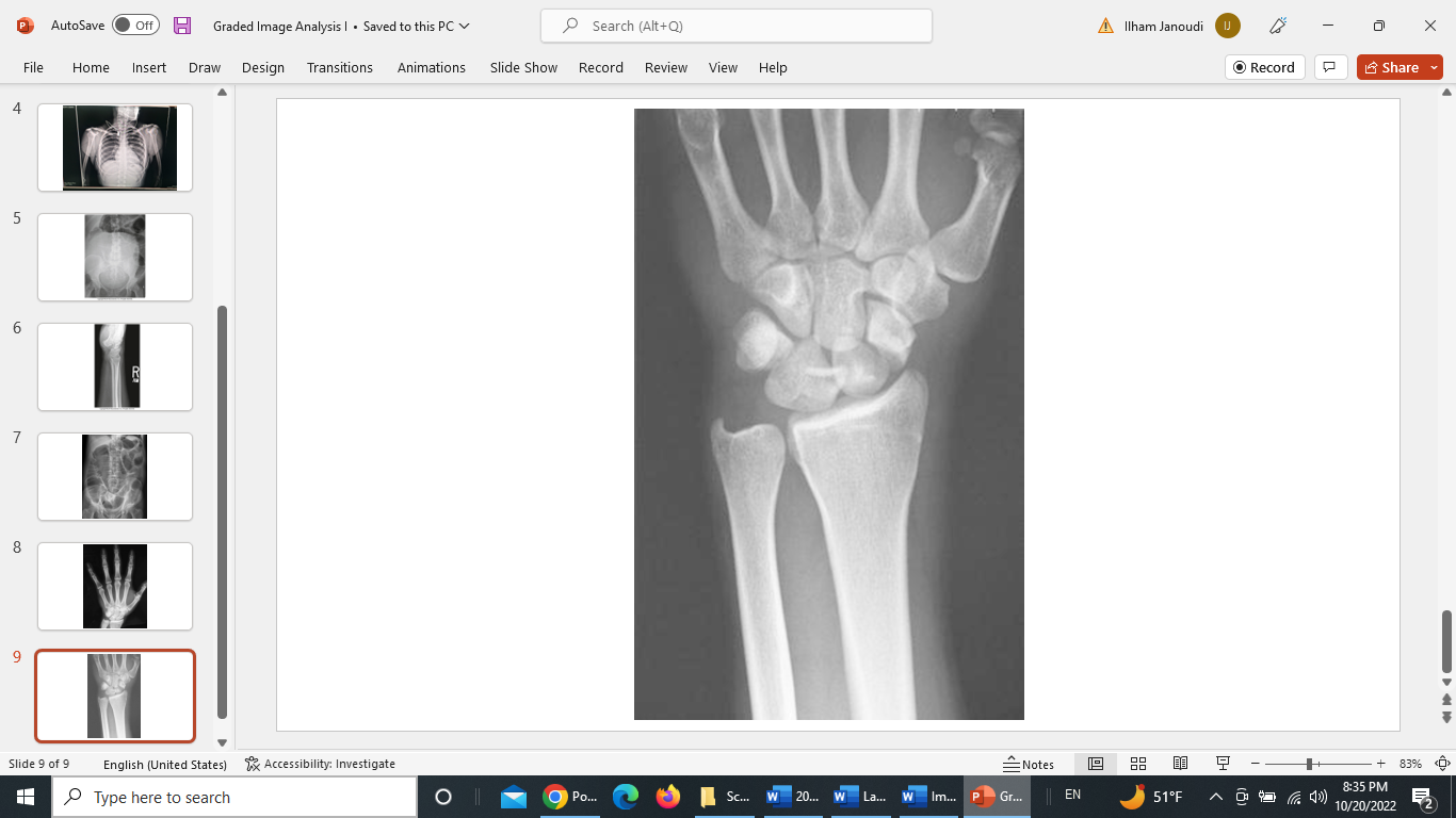 Solved Image 1 – PA Hand x-ray Is this image | Chegg.com