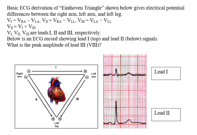 Solved Basic ECG derivation of “Einthoven Triangle” shown | Chegg.com