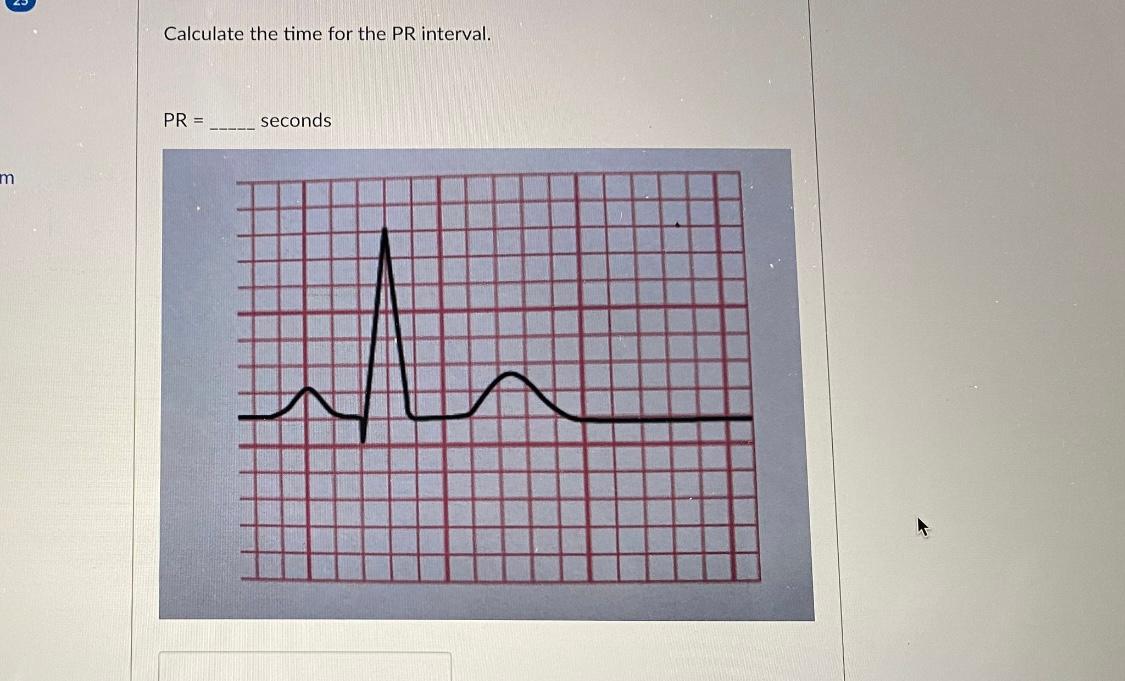 Solved Calculate the time for the PR interval. PR = seconds | Chegg.com