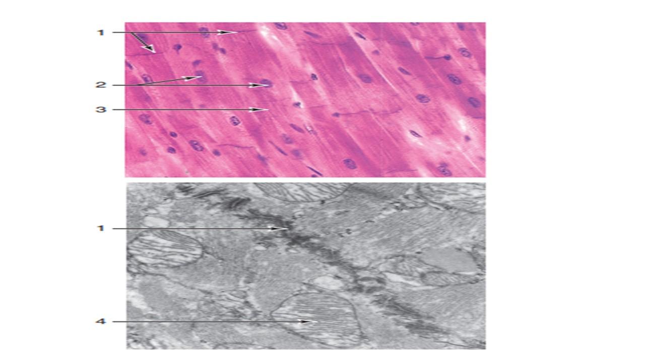 Solved identify the type of muscle tissue seen below and | Chegg.com