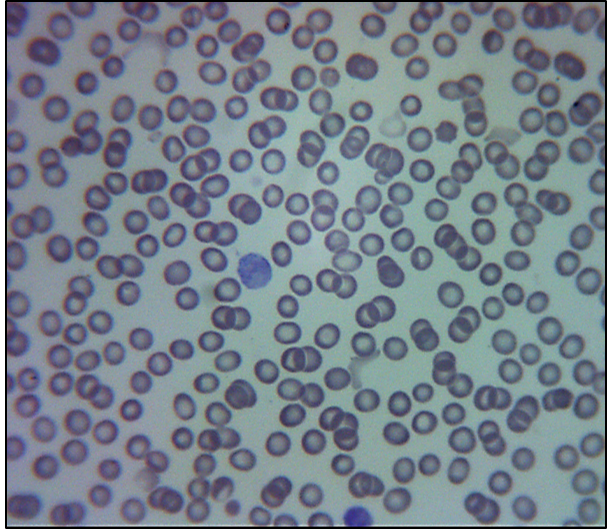 Solved Label at least one leukocyte, erythrocyte, and | Chegg.com
