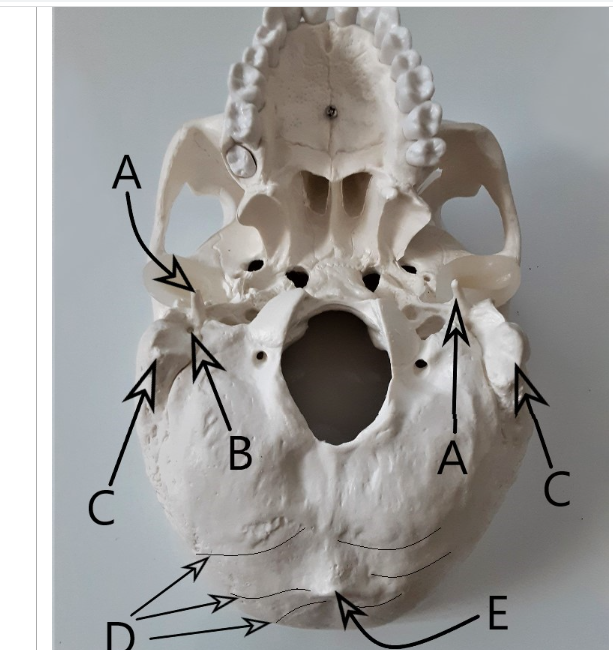 Solved 1.The projection "A" is [ Select ] ["zygomatic | Chegg.com