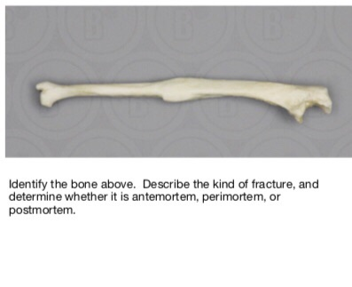 Solved Identify the bone above. Describe the kind of | Chegg.com