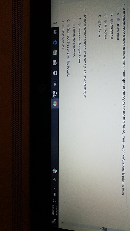 Solved EC demauts may be caused by A OViral infections or a | Chegg.com