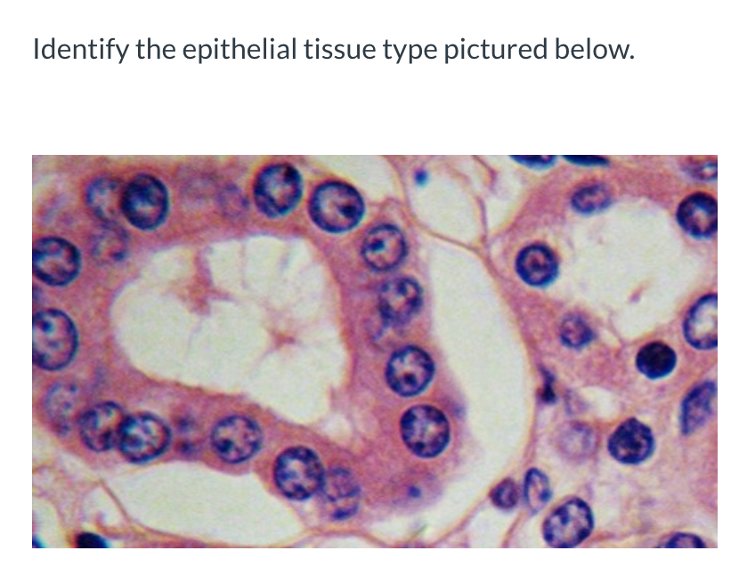 Solved Identify the epithelial tissue type pictured below. 及 | Chegg.com