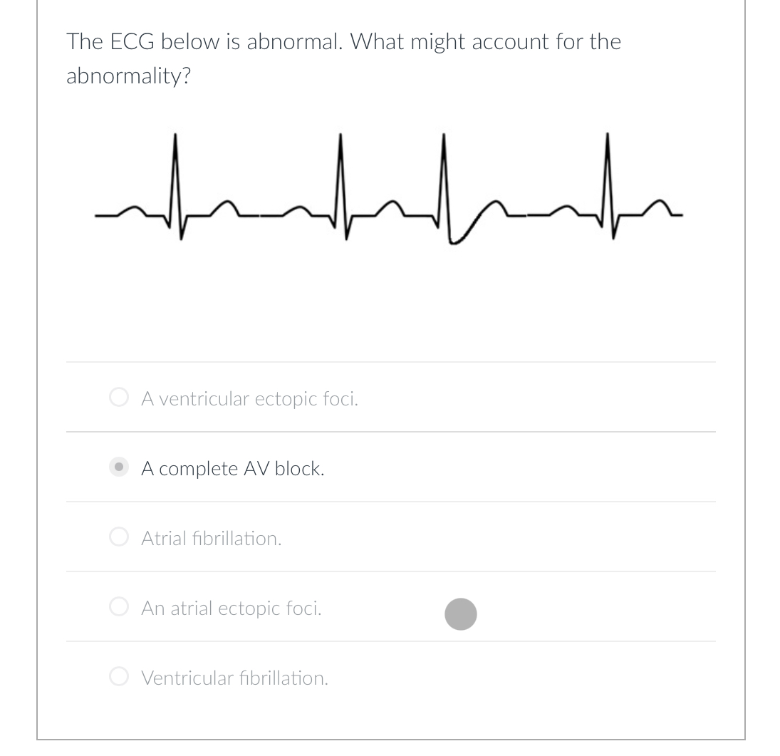 Solved The ECG below is abnormal. What might account for the | Chegg.com