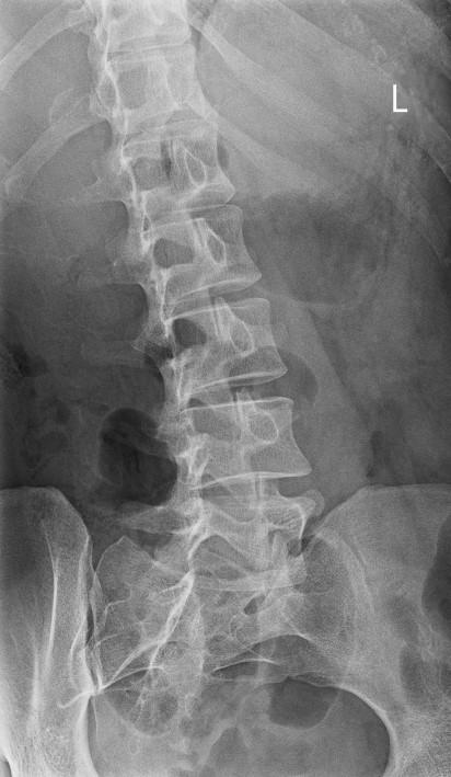 Solved be specific: Locate the left L3 pars | Chegg.com