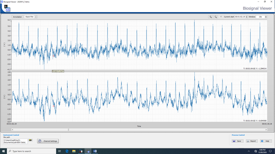 Solved Procedure National Instruments myDAQ is an relatively | Chegg.com